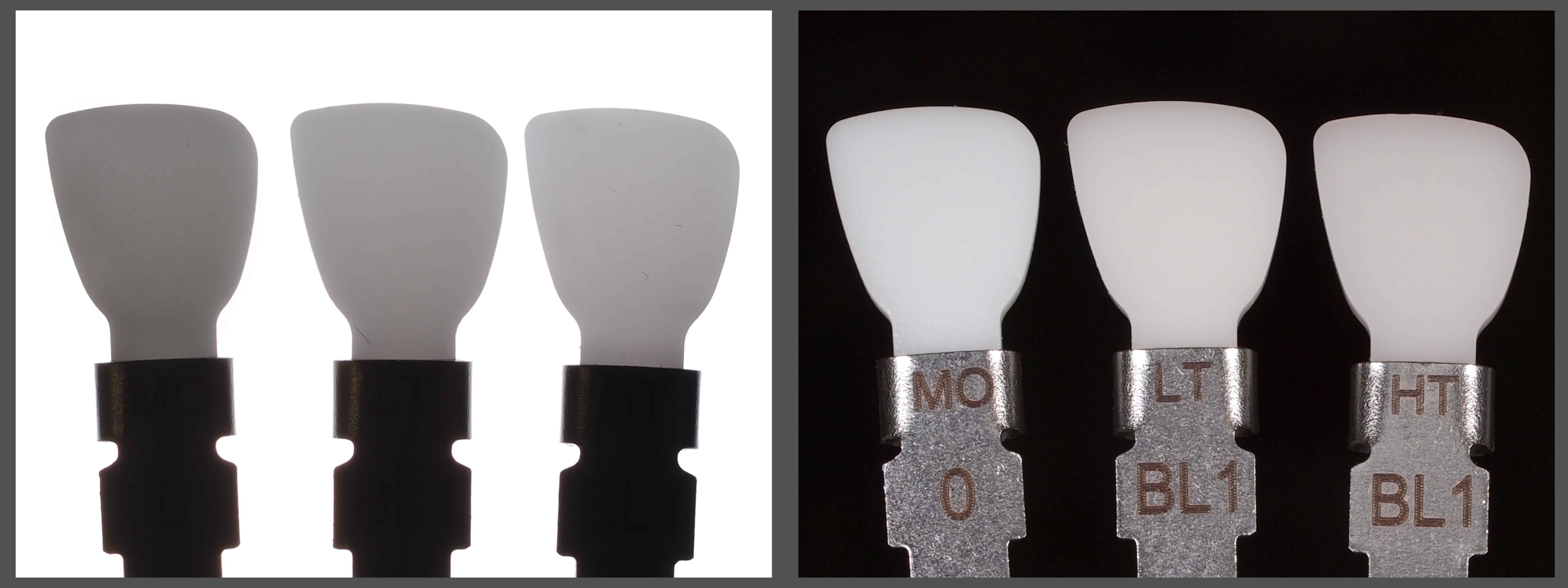 Case 17, Esthetic Treatment of 6-11 with e.max Crowns | In-House Dental ...